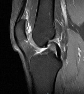 Rund um Radiologie - BDT